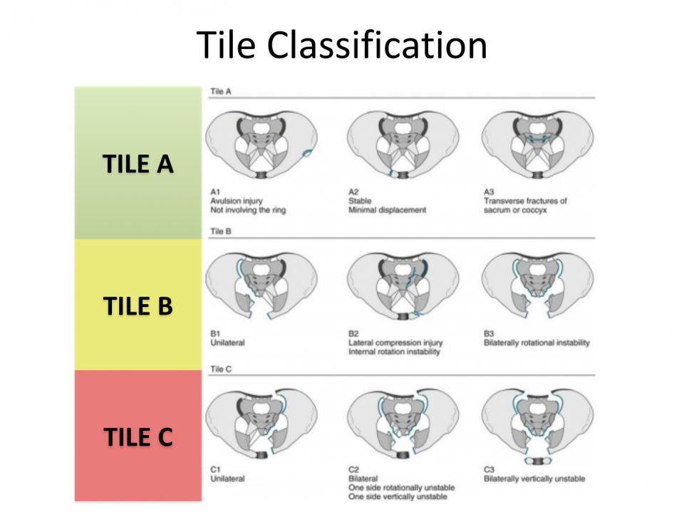 Opening the Book: Pelvic Trauma in the ED - EMOttawa Blog