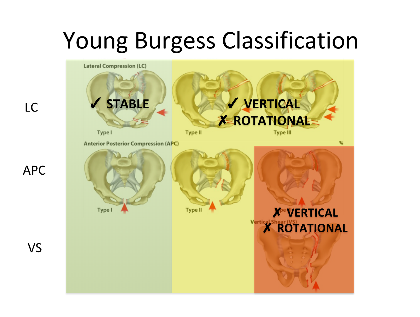 Opening the Book: Pelvic Trauma in the ED - EMOttawa Blog