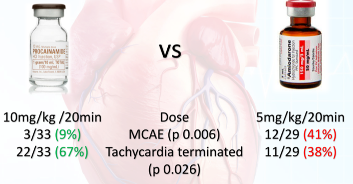 My Heart is Racing! Select Cardiac Arrhythmias in the ED - EMOttawa Blog