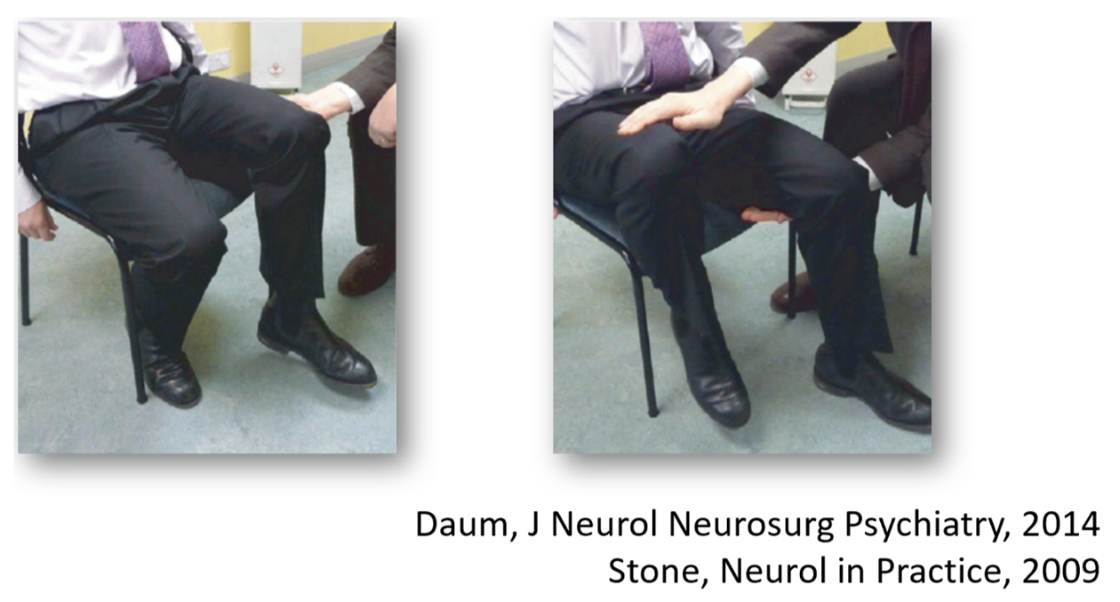 Caring for Patients with Functional Neurological Disorders in the ED ...