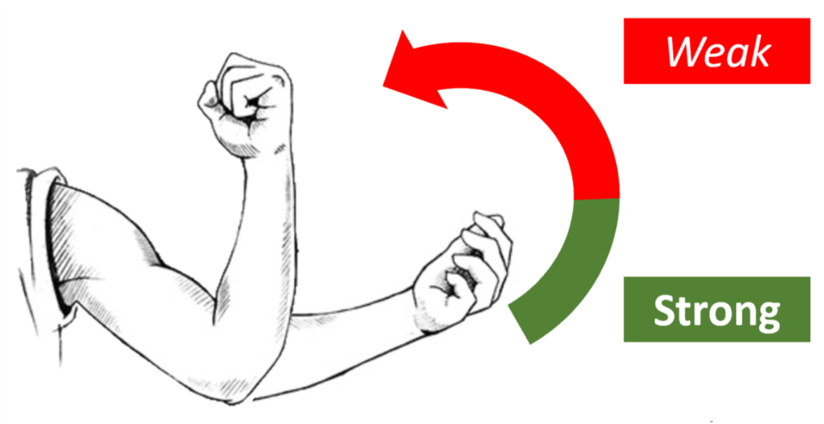 Caring for Patients with Functional Neurological Disorders in the ED ...