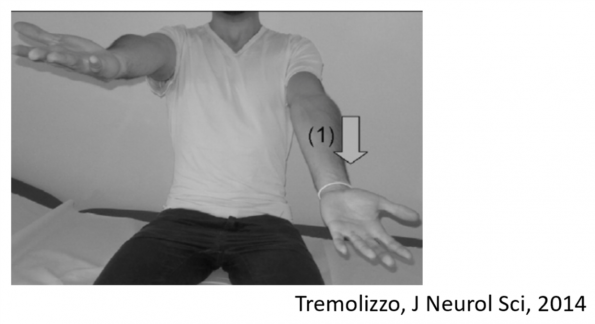 Caring for Patients with Functional Neurological Disorders in the ED ...