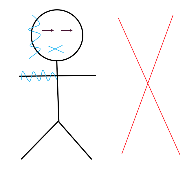 Identifying stroke mimics in the ED - EMOttawa Blog