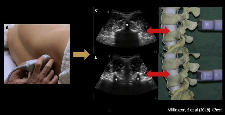 Echoes: Taking Your POCUS Game to the Next Level - EMOttawa Blog