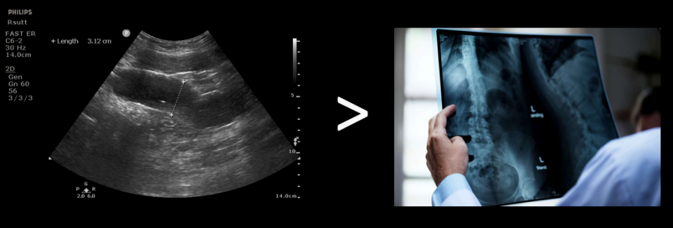 Echoes: Taking Your POCUS Game to the Next Level - EMOttawa Blog