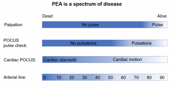 Management of PEA: in need of resuscitation? - EMOttawa Blog