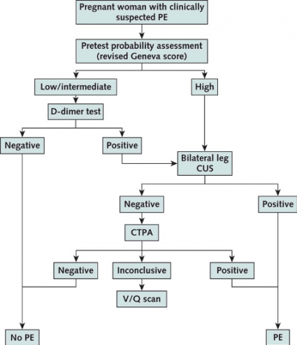 Pulmonary Embolism in Pregnancy: Diagnostic Dilemmas - EMOttawa Blog