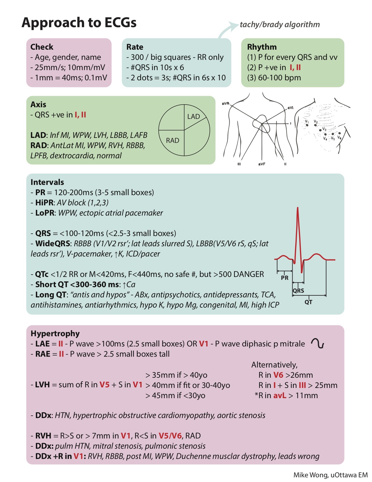 Approach to the ECG - EMOttawa Blog