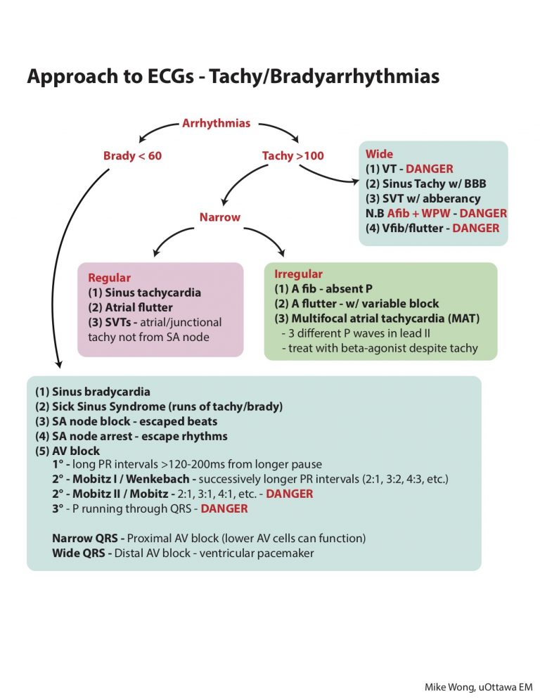 Approach to the ECG - EMOttawa Blog