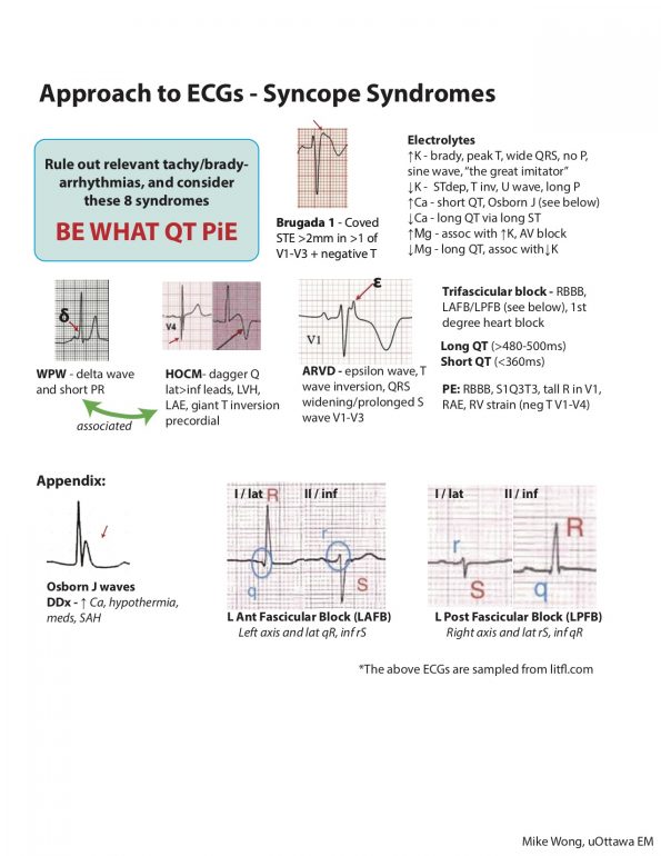 Approach to the ECG - EMOttawa Blog