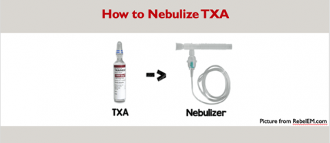 Tick. Tock. It's Time For a TXA Update - EMOttawa Blog