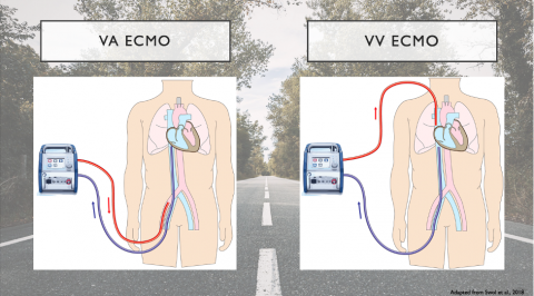 Are We Ready for ECMO on the Ground Floor? - EMOttawa Blog