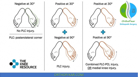 Le Genou: Everything you Knee-d to know! - EMOttawa Blog