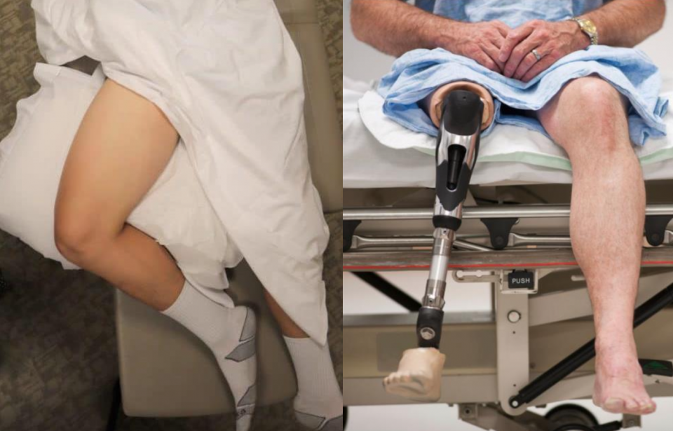 Mastery of DVT PoCUS - EMOttawa Blog