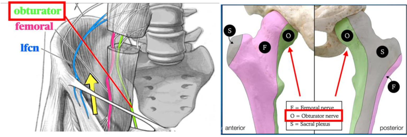 Fascia's Back: The Supra-Inguinal Fascia Iliaca (SIFI) Block - EMOttawa ...