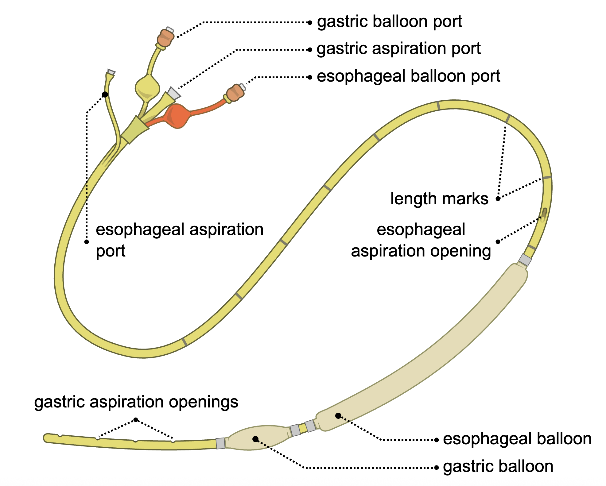 Blakemore Tube Insertion - EMOttawa Blog